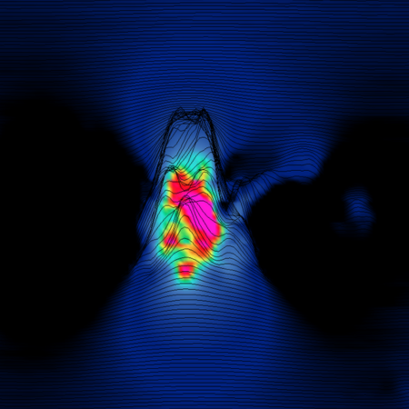 MDS™ Flex Platform | T.D. Williamson